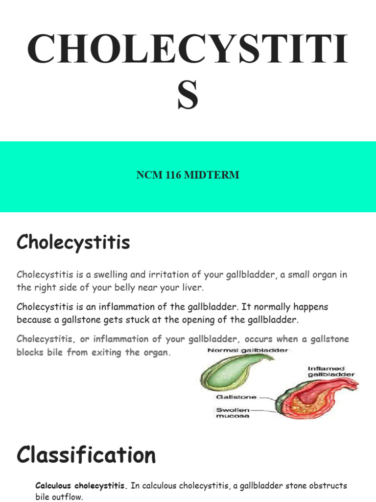 CHOLECYSTITIS | PDF | Gallbladder | Medical Specialties