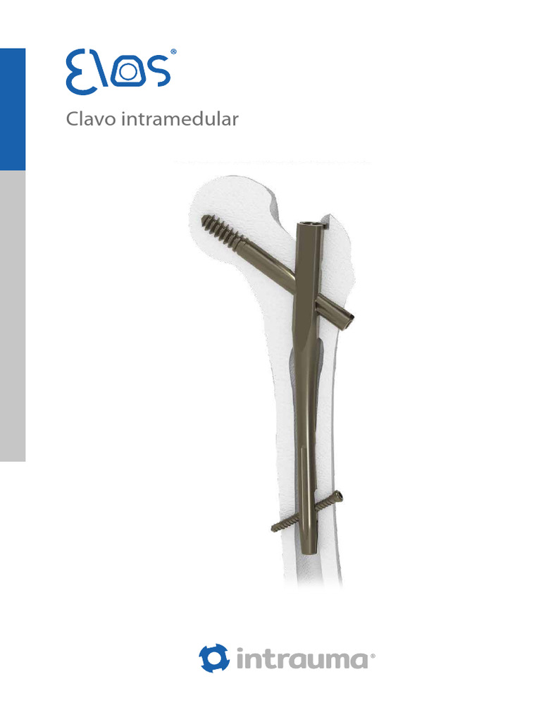 Intrauma Elos Clavo Intramedular | Descargar gratis PDF | Tornillo ...