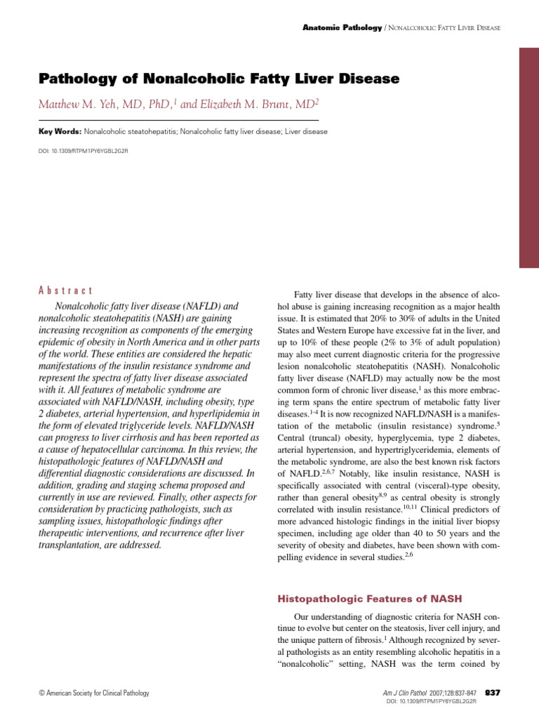 Pathology of Nonalcoholic Fatty Liver Diseasel | PDF | Cirrhosis ...
