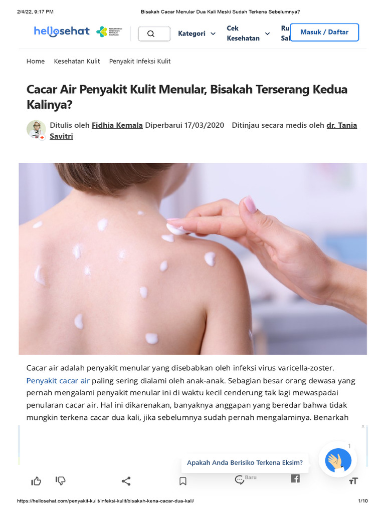 "Bisakah Cacar Air Menyerang Dua Kali?" | PDF