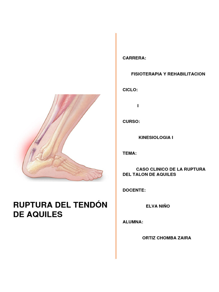 Ruptura Del Talón de Aquiles | PDF | Tobillo | Especialidades Medicas