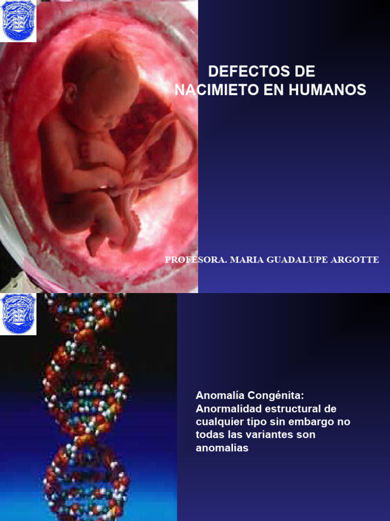 Defectos Del Nacimiento, Embriologia! | PDF | Síndrome de Down | Mutación