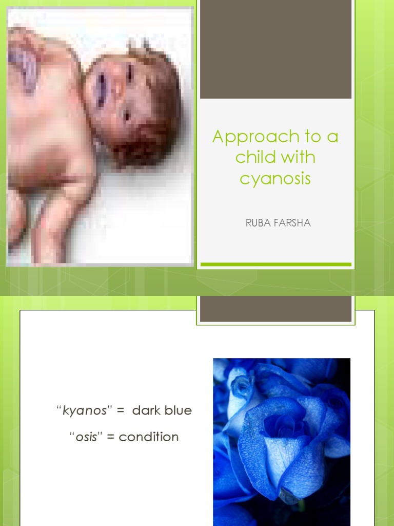 cyanosis | Hypoxia (Medical) | Medicine