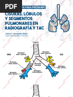 Segmentos Pulmonares en Tomografía y Rayos X | PDF | Tórax (anatomía ...