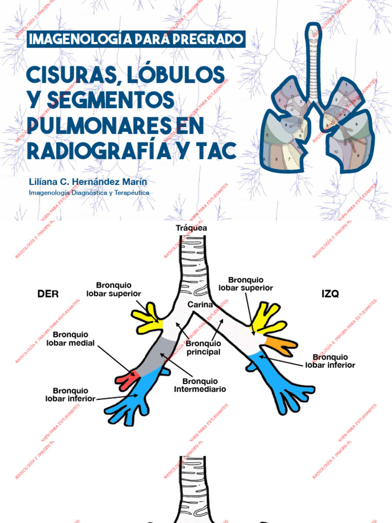 Cisuras, Lóbulos y Segmentos Pulmonares en RX y TAC - Watermark ...