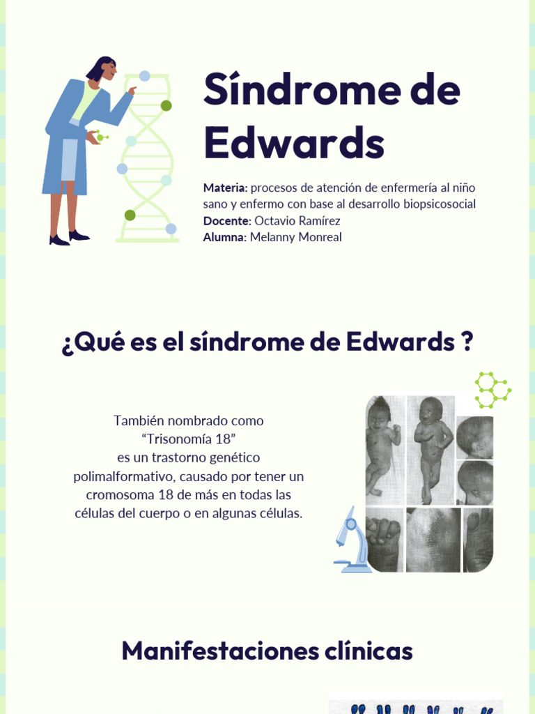 Síndrome de Edwards: Diagnóstico y Tratamiento | PDF | Enfermedades y ...
