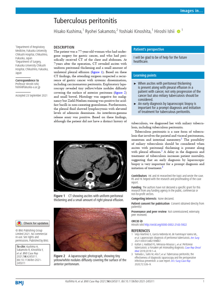 Tuberculous Peritonitis | PDF | Peritoneum | Tuberculosis