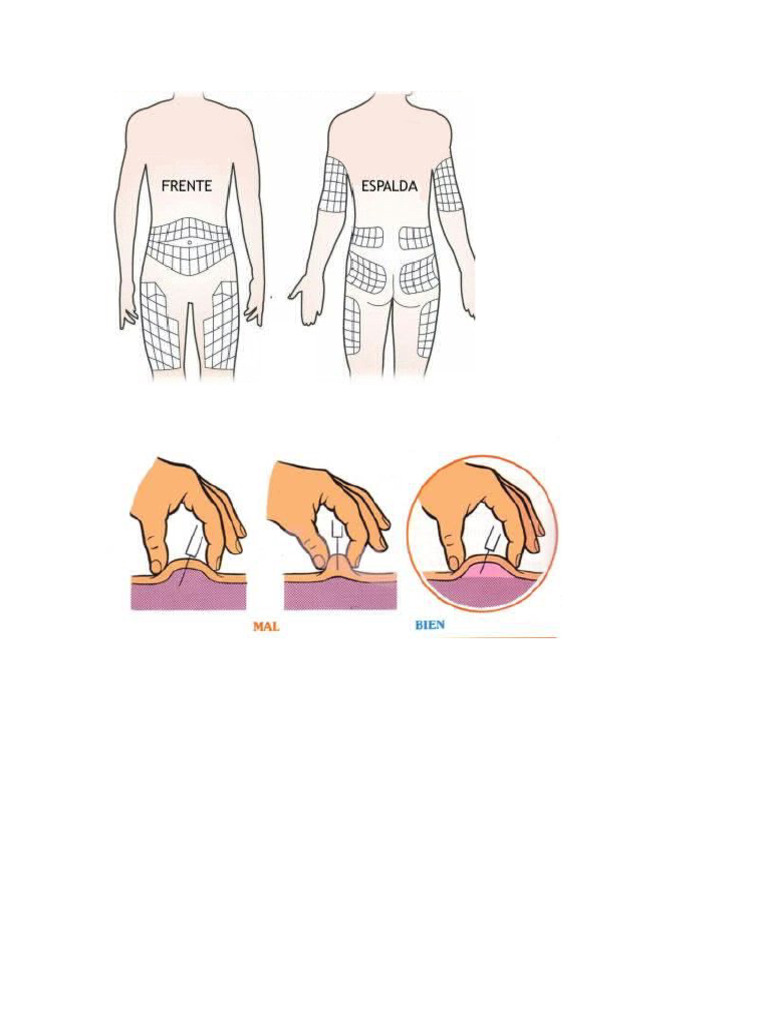Aplicacion Insulina Pdf