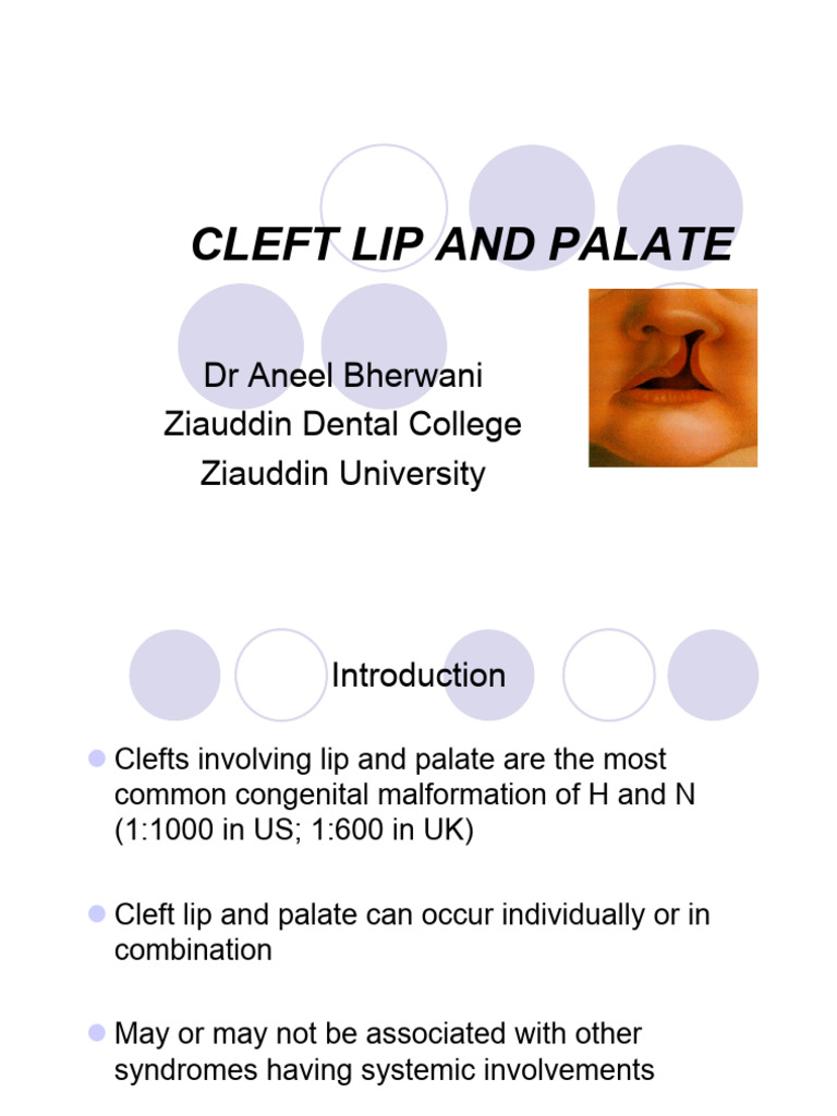Cleft Lip and Palate | PDF | Orthodontics | Tooth