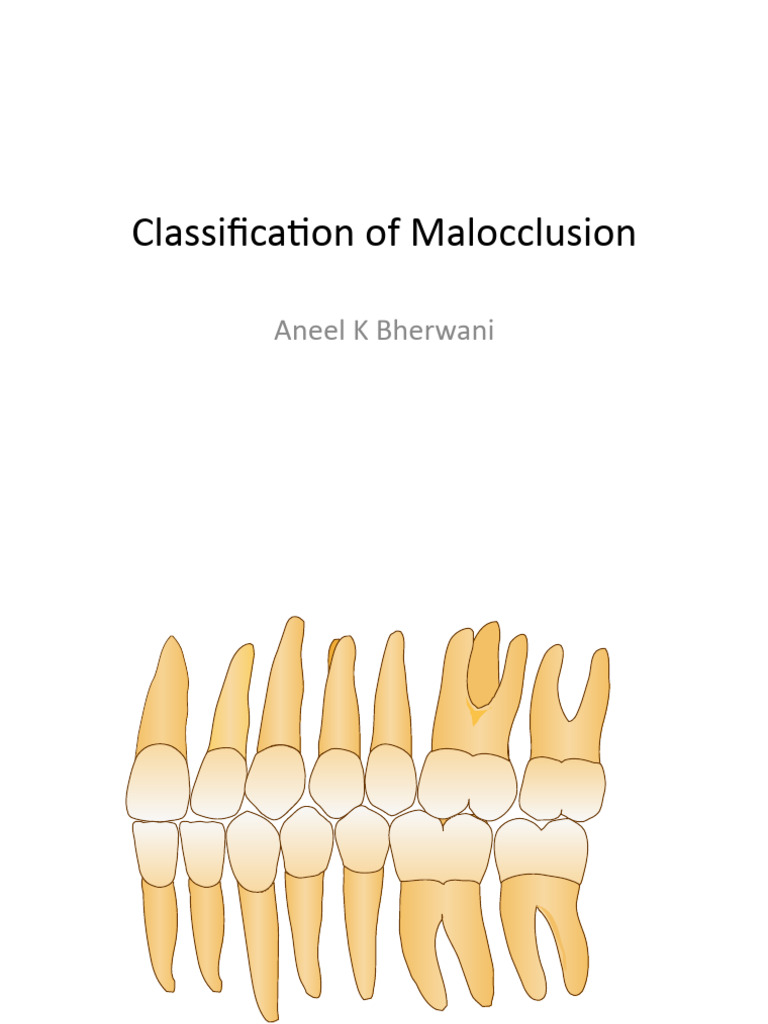 Classification of Malocclusion | PDF