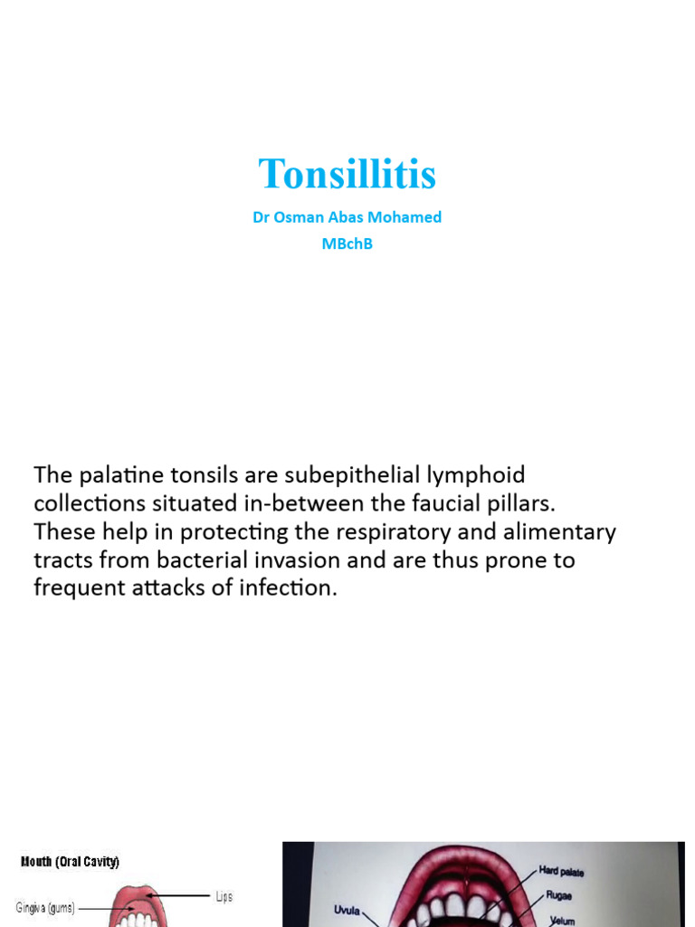 5 Tonsillitis | PDF | Infection | Surgery