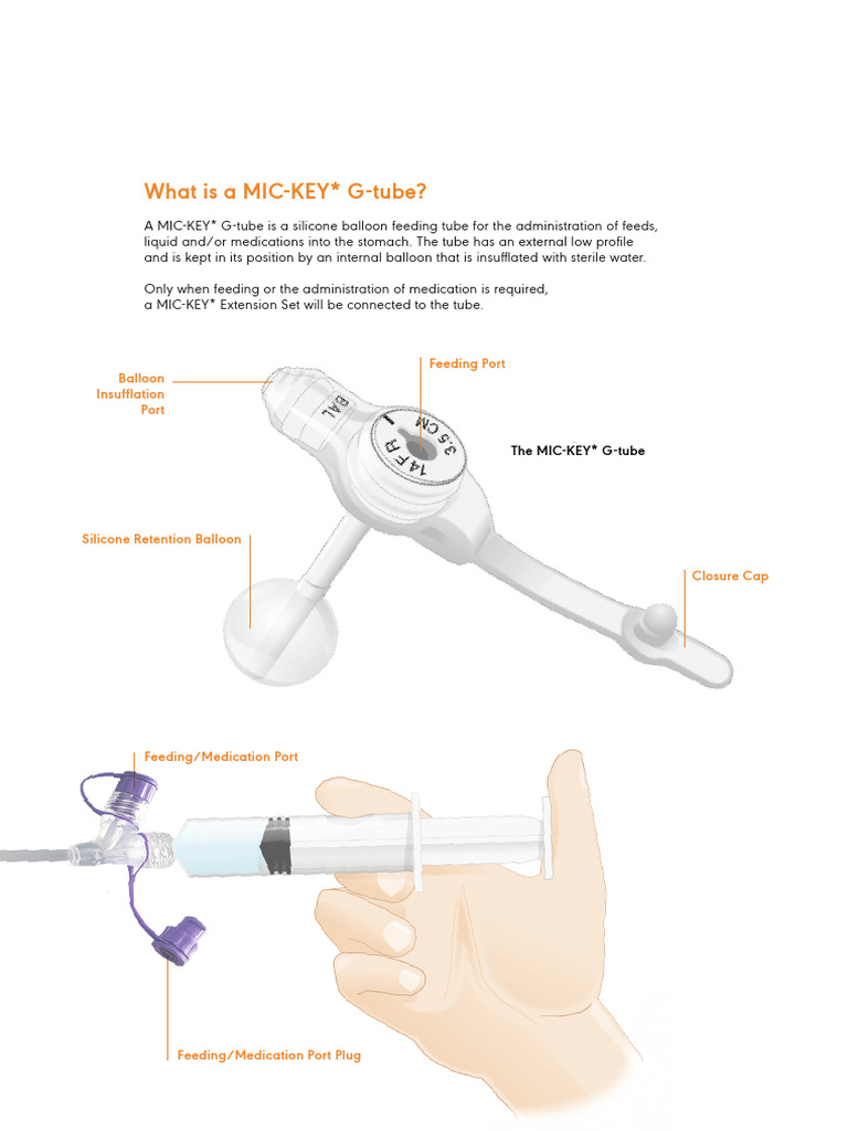 MIC-KEY G-Tube: Care and Benefits Guide | PDF | Clinical Medicine ...