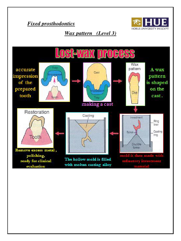 Wax Pattern Techniques in Dentistry | PDF
