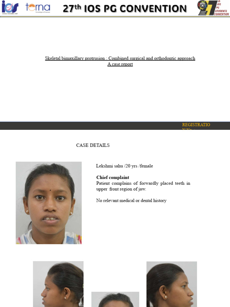 Skeletal Bimaxillary Protrusion - Copy (Repaired) | PDF | Dentistry ...