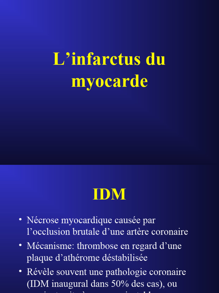 Infarctus du Myocarde : Diagnostic et Traitement | PDF | Infarctus du ...