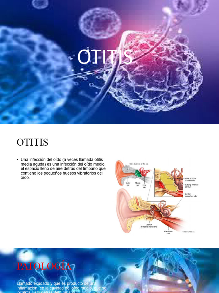 Otitis | PDF | Oído | Inmunología