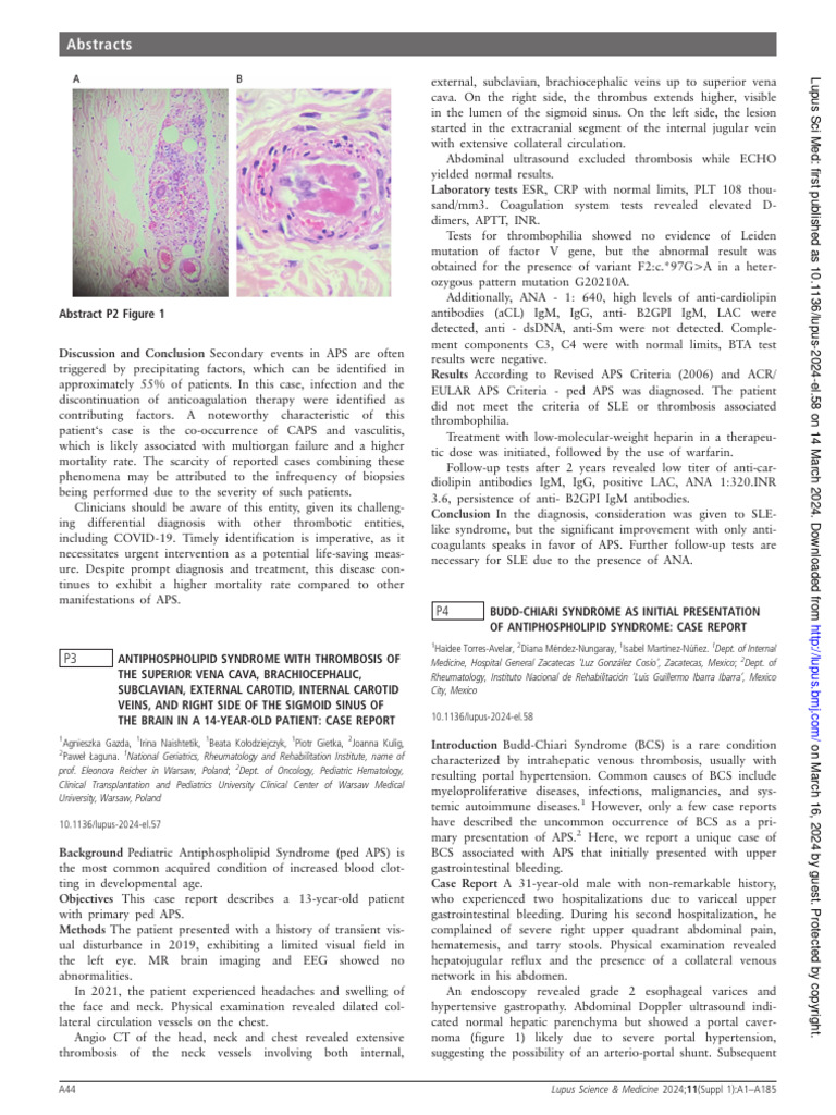 P4 Budd-Chiari Syndrome As Initial Presentation of | PDF | Medical ...