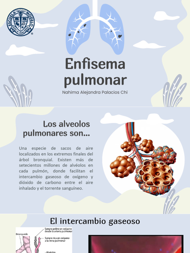 Enfisema Pulmonar: Causas y Tratamiento | PDF | Pulmón | Enfermedades y ...