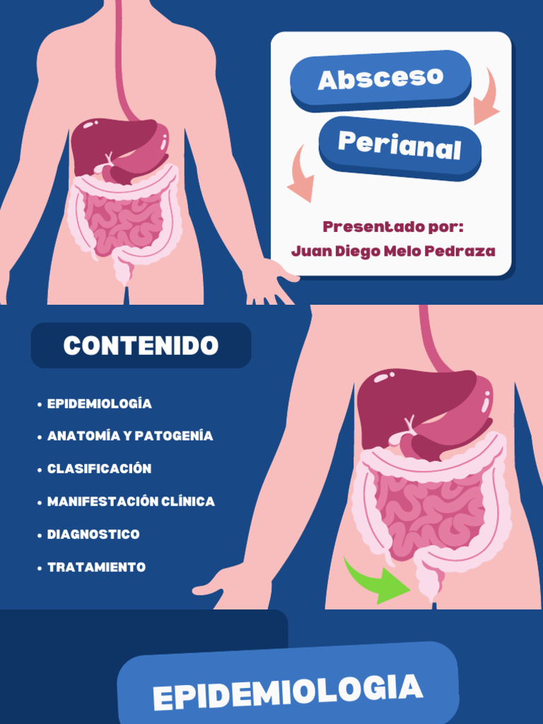 Abscesos Perianales | PDF | Ciencias de la Salud | Medicina