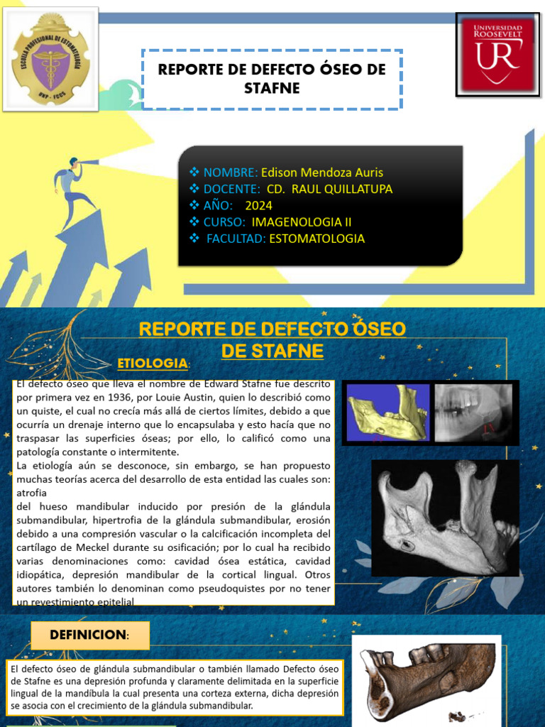 Defecto Óseo de Stafne: Diagnóstico y Tratamiento | PDF | Hueso ...