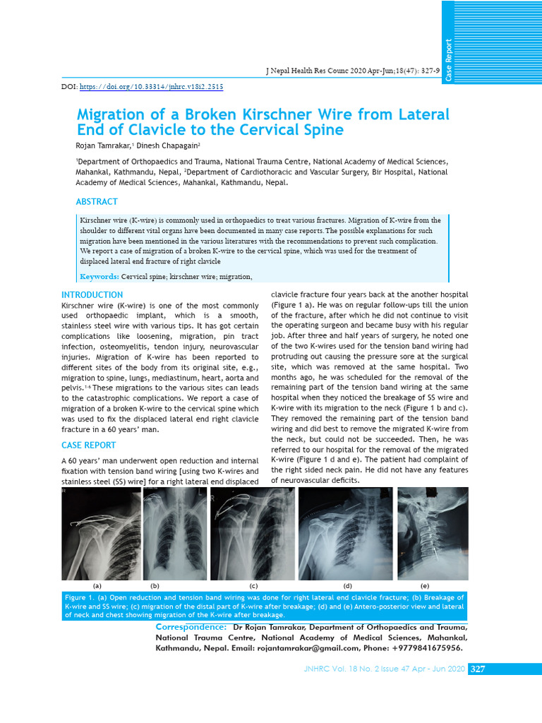 Migration of A Broken Kirschner Wire From Lateral | PDF | Orthopedic ...