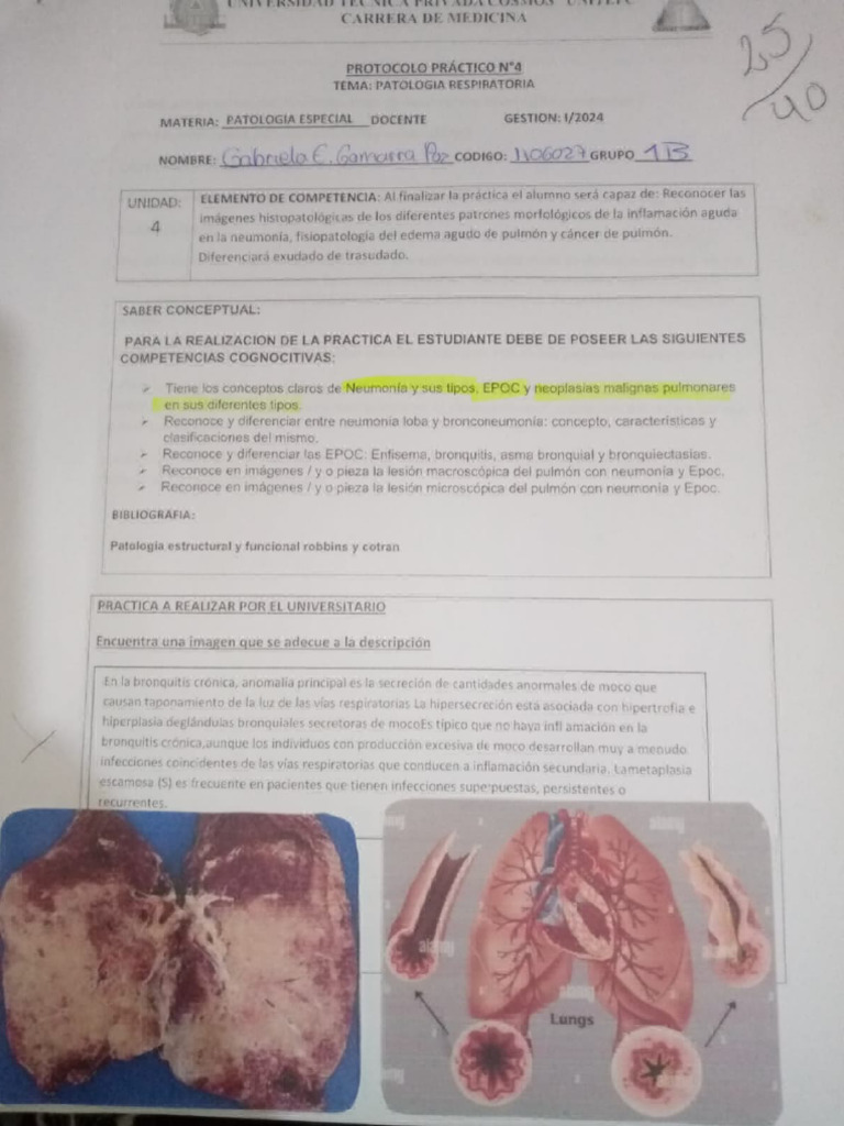 Protocolo 4 | PDF | Bronquitis | Neumonía