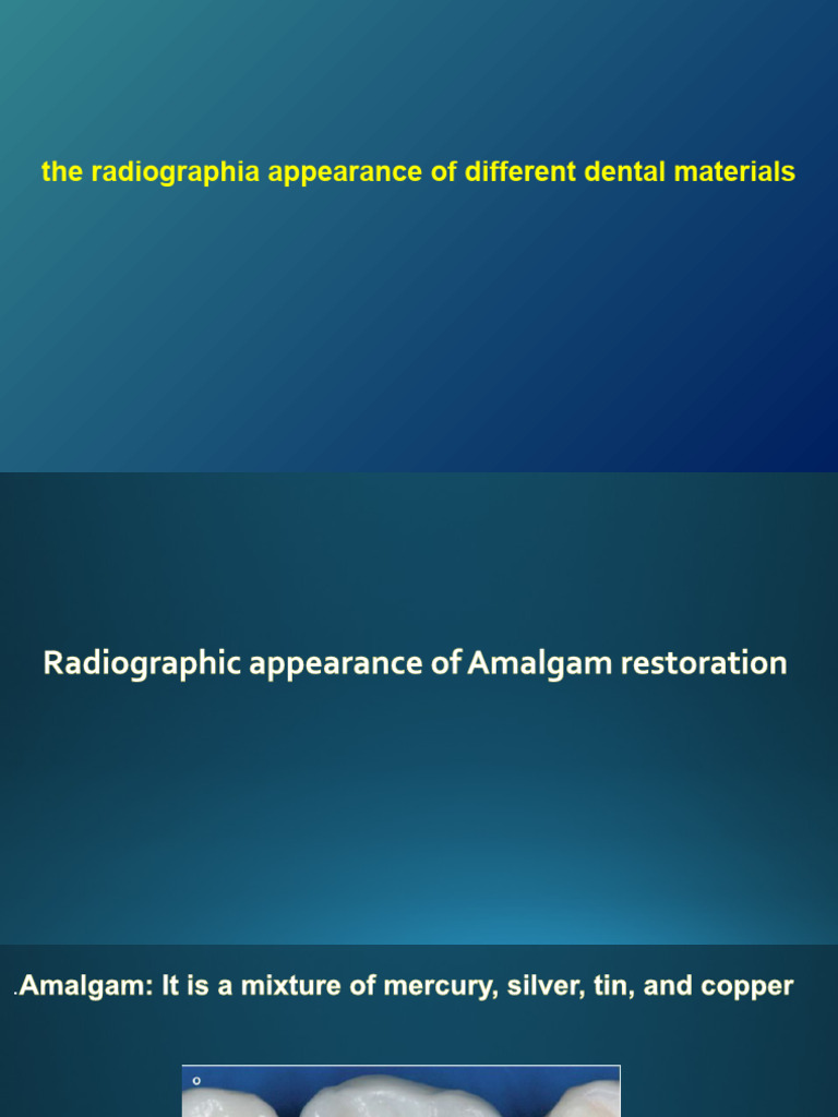 The Radiographia Appearance | PDF | Dental Implant | Mouth