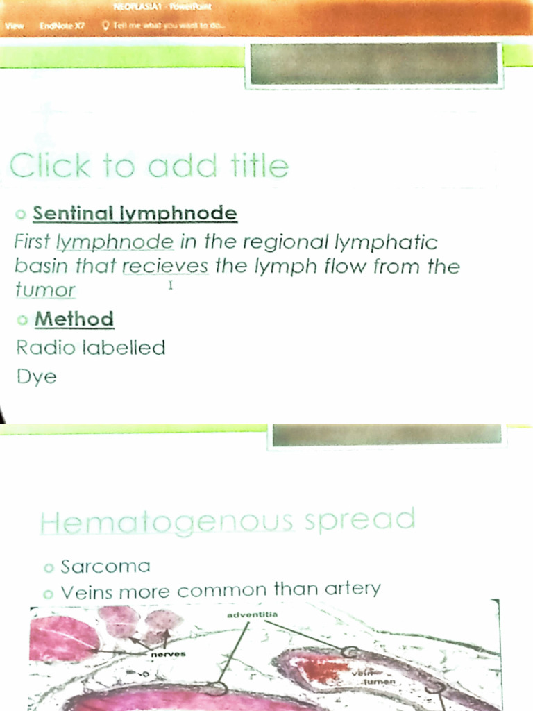 pathology | PDF | Adenocarcinoma | Cancer