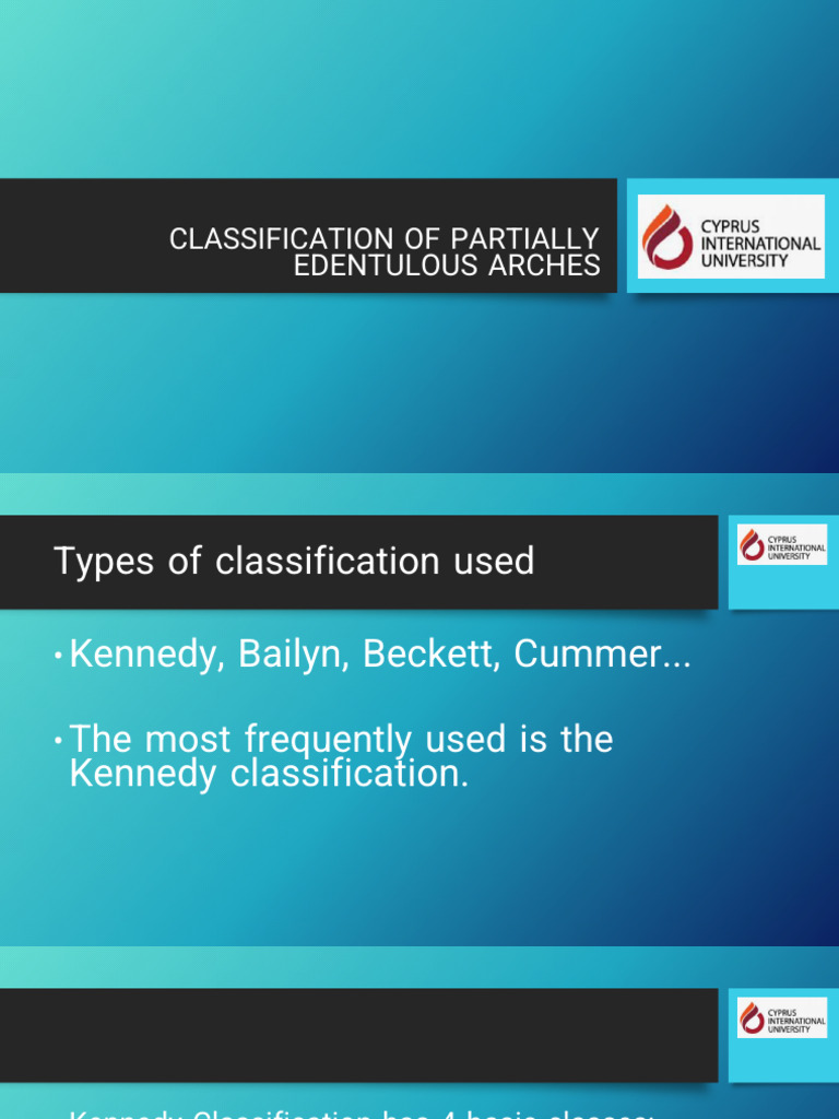 Classification of Partially Edentulous Arches | PDF | Dentures ...
