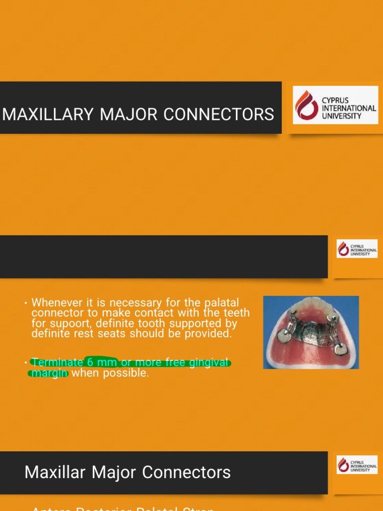 Maxillary Major Connectors | PDF | Anatomical Terms Of Location | Dentures