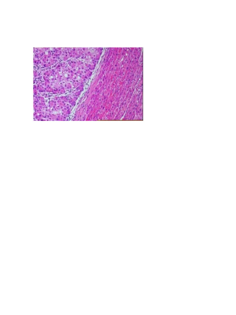 LIVER | PDF