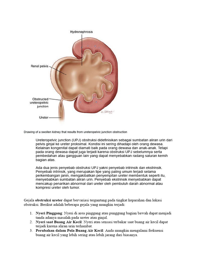 Panduan Obstruksi Ureter dan Pyeloplasty | PDF