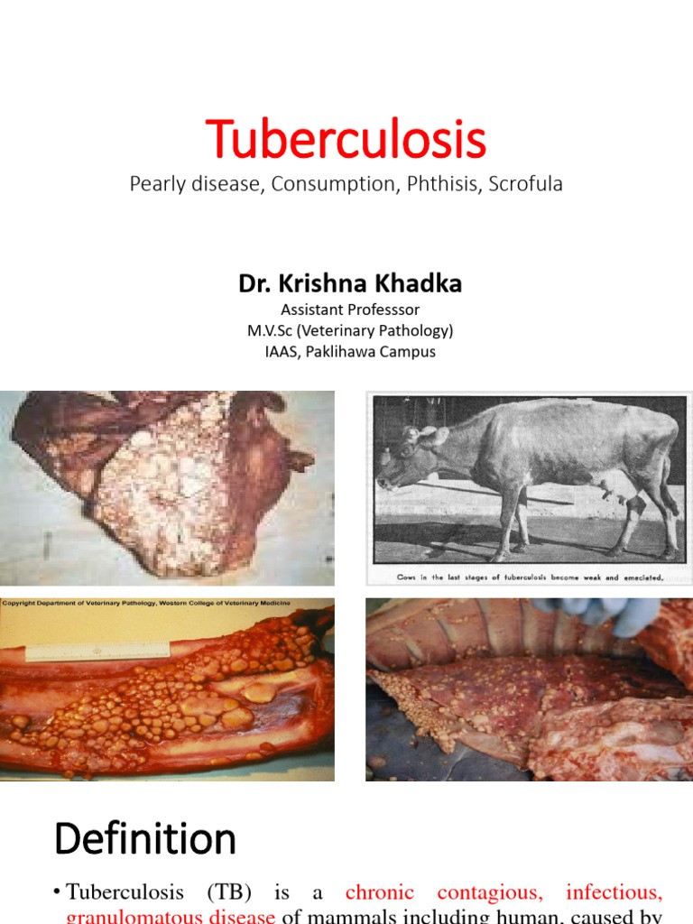 1 Tuberculosis | PDF | Tuberculosis | Lymphatic System