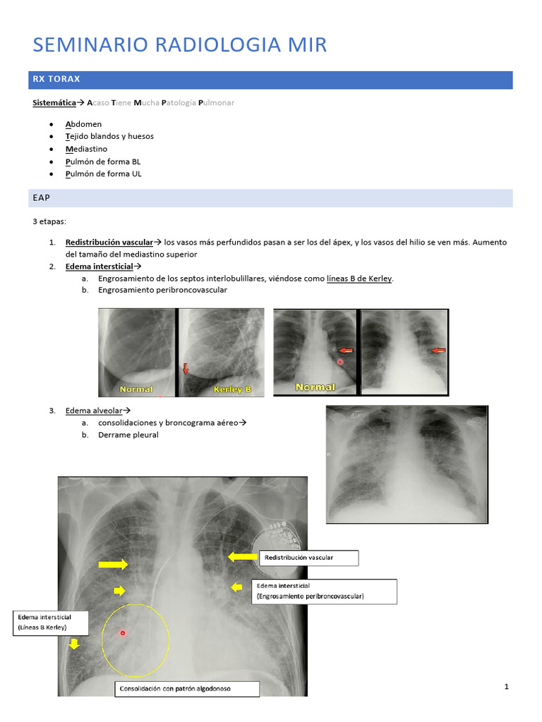 Seminario Radiologia Mir | PDF | Especialidades Medicas | Enfermedades ...