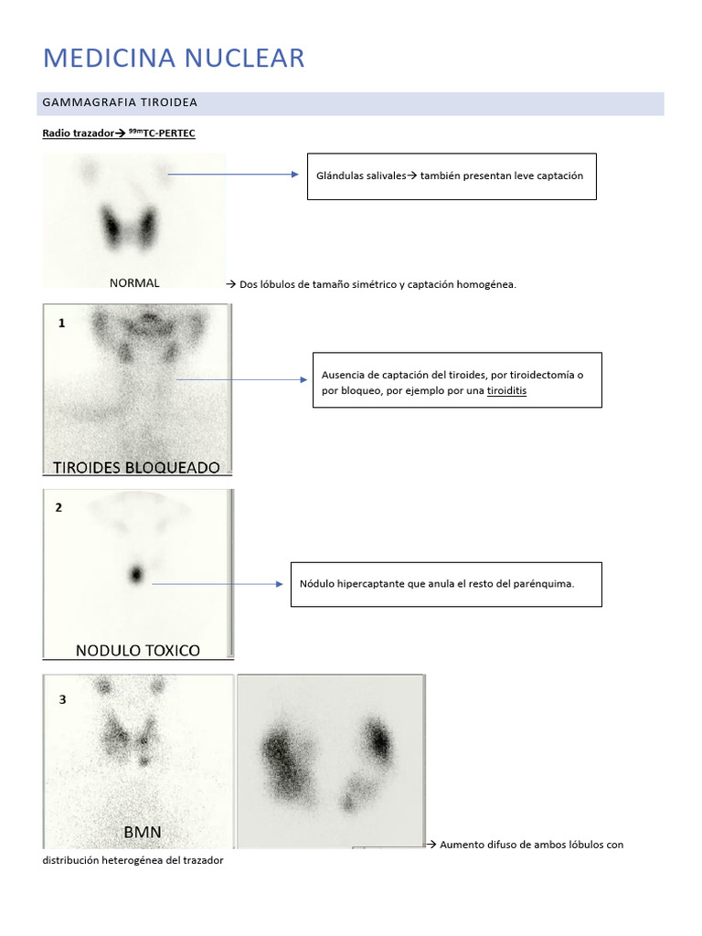 Medicina Nuclear | PDF | Tiroides | Trazador radiactivo