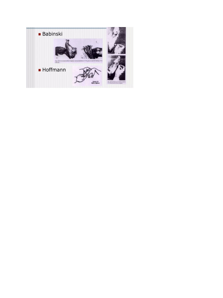 REFLEKS PATOLOGIS | PDF