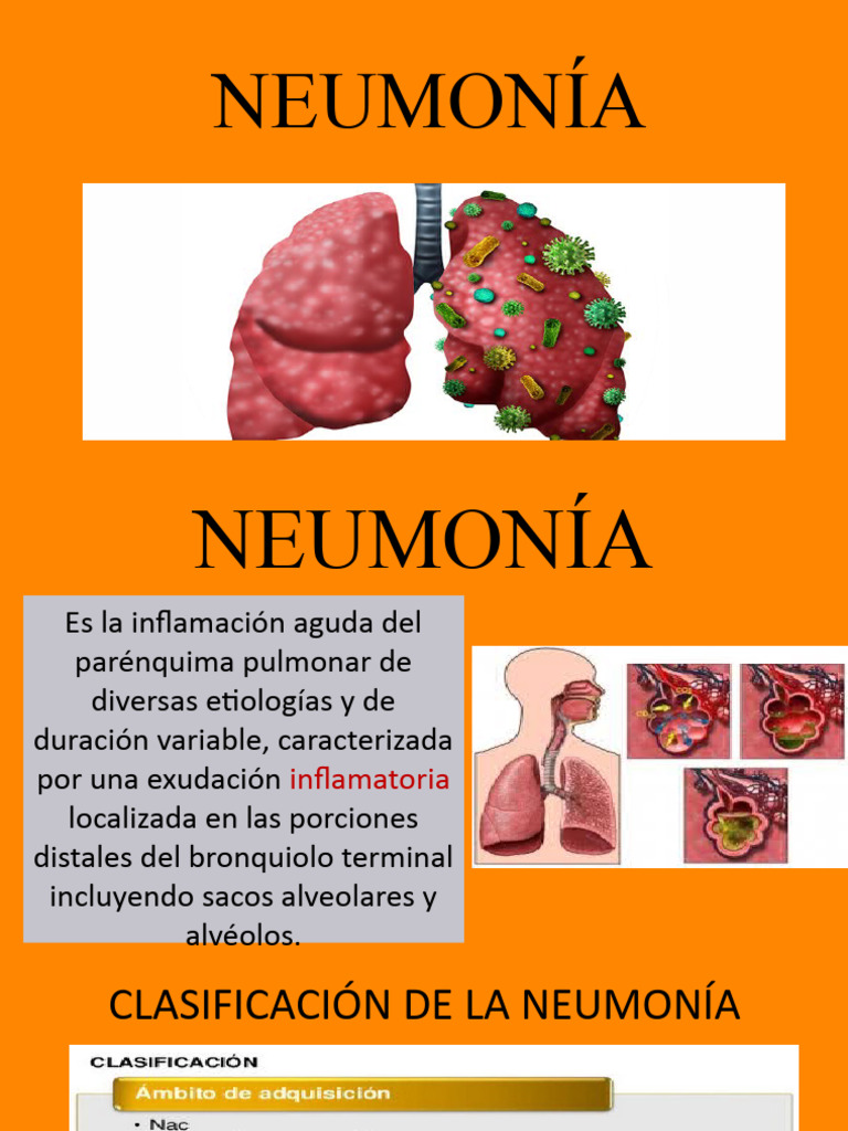 Neumonía | PDF | Neumonía | Medicina