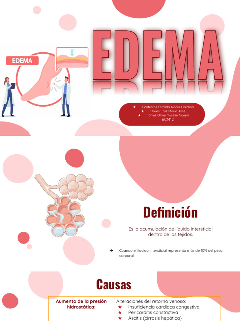 Causas y Tipos de Edema en Tejidos | PDF | Edema | Fisiología