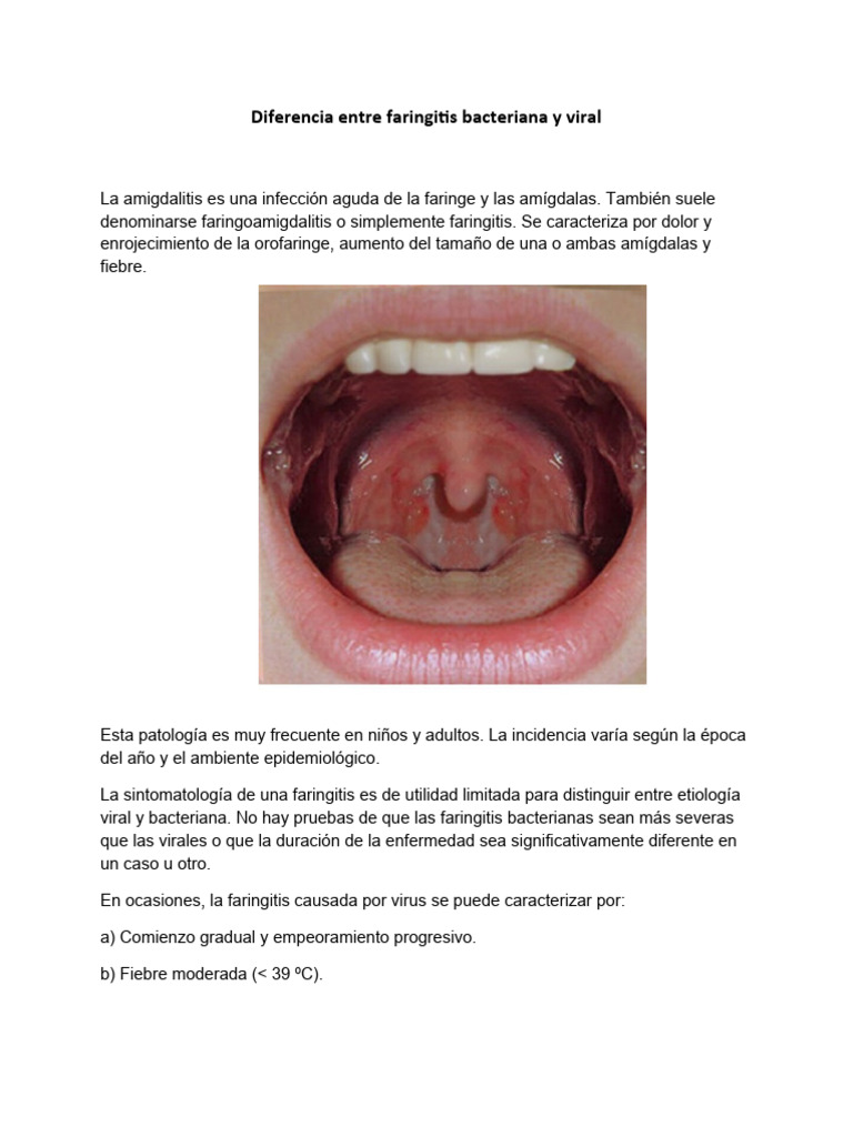 Faringitis Bacteriana y Viral | PDF | Estreptococo | Ciencias de la Salud