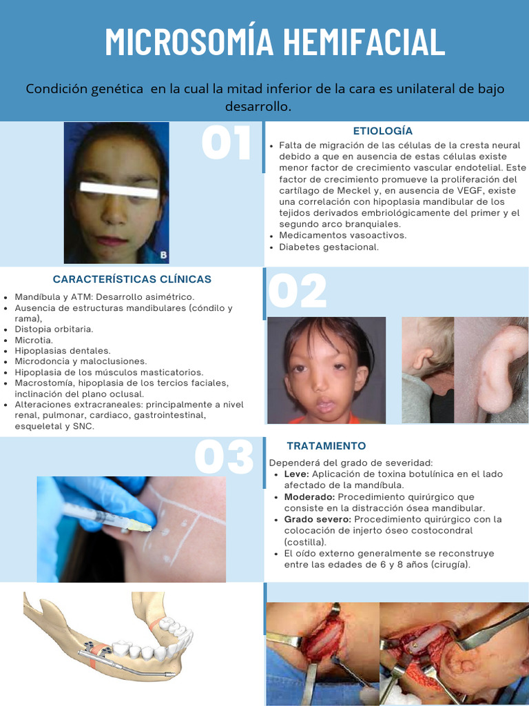 MICROSOMÍA HEMIFACIAL | PDF | Enfermedades y trastornos | Anatomía