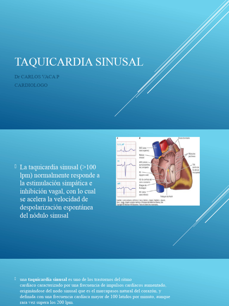 Taquicardia Sinusal CLASE | PDF | Medicina CLINICA | Electrofisiología ...