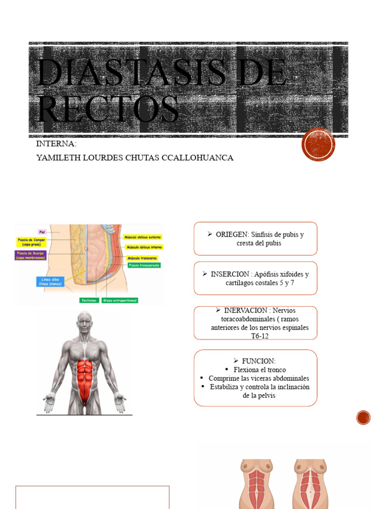 EXPOSICION DIASTASIS DE RECTOS | PDF