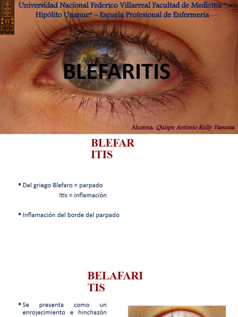 Blefaritis Diapos | PDF | Enfermedades y trastornos | Especialidades Medicas