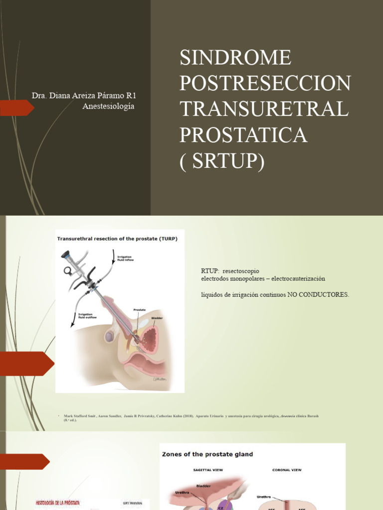 Consideraciones Anestesicas en Rtup | PDF | Especialidades Medicas ...