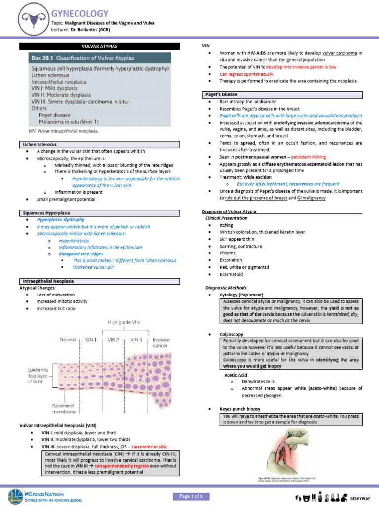 GYNE - Malignant Diseases of The Vagina and Vulva (RCB) | PDF | Cervical Cancer | Vagina
