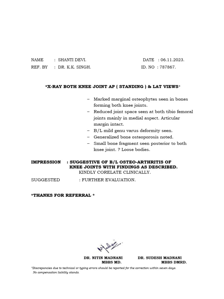 Bilateral Knee Osteoarthritis X-Ray Report | PDF