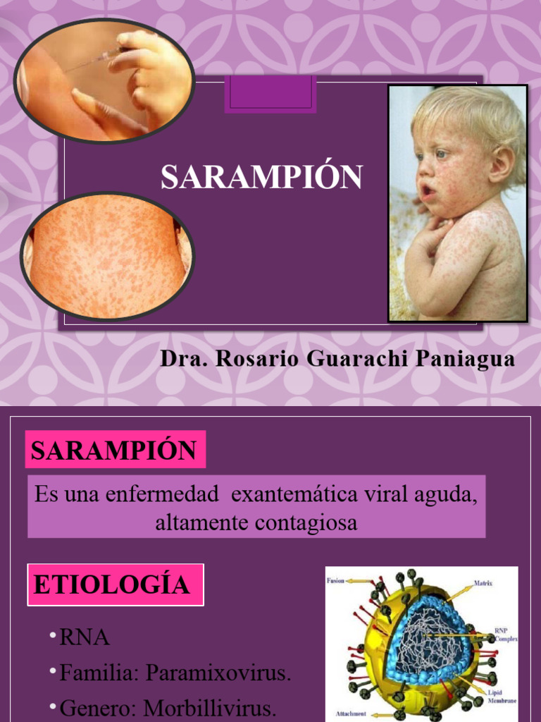 Sarampion 160211044733 | PDF | Cuidado de la salud | Humanidades Médicas