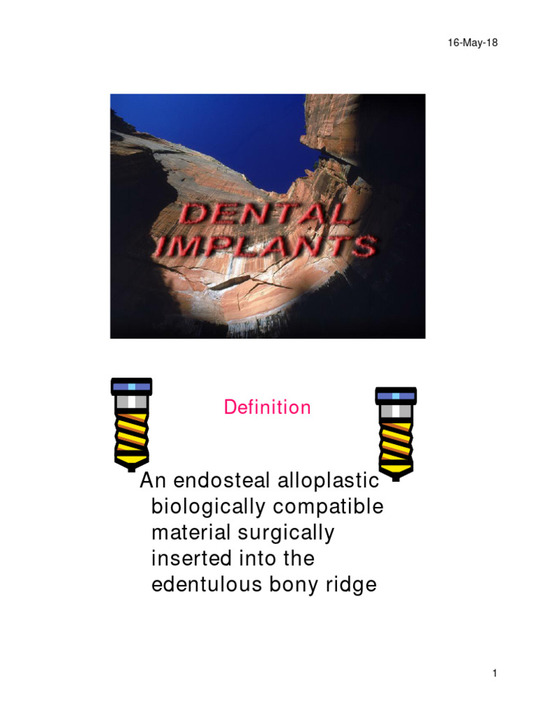 Dental Implants | PDF | Dental Implant | Dentistry Branches