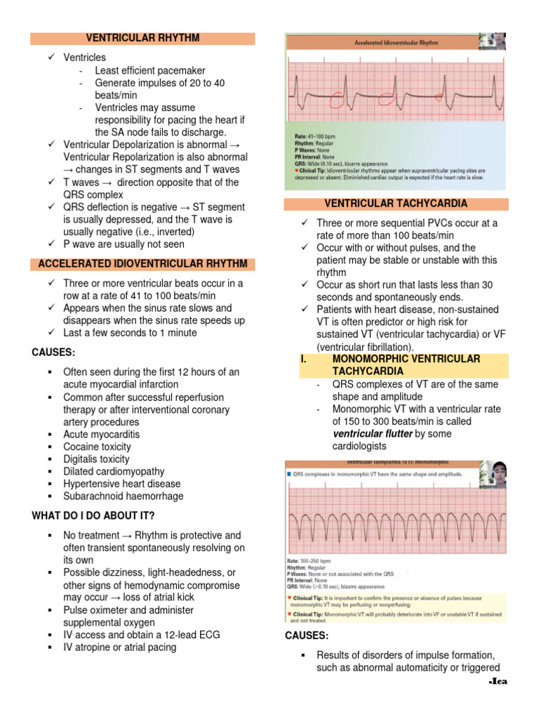 VENTRICULAR-RHYTHM | PDF | Electrocardiography | Heart