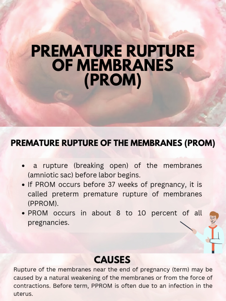 Prom | PDF | Childbirth | Preterm Birth